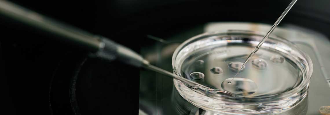 In-vitro Maturation (IVM) as an Alternate Infertility Treatment ...