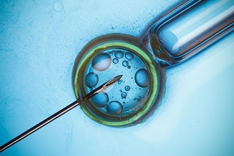 Basics of Intralipid Infusion and the Effects on IVF Treatments