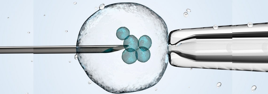 A Complete Guide to Zygote Intrafallopian Transfer - Fertilitytips.com
